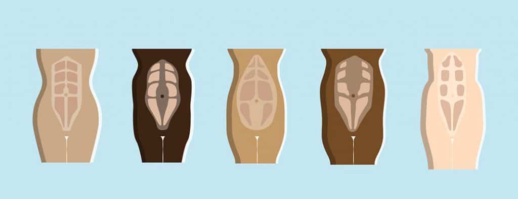 What is Diastasis? And What You Can Do About it - Health Perch